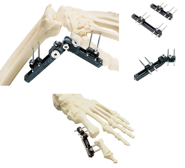 Membros Superiores e Inferiores – MB Osteos